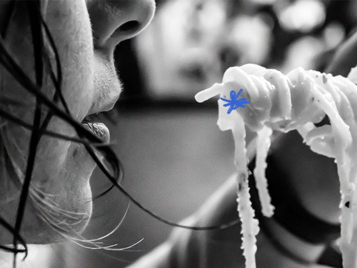 Aerophagia: Causes and treatment