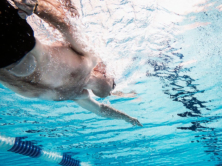 Colostomy prolapse: Symptoms, treatment, FAQ, and more