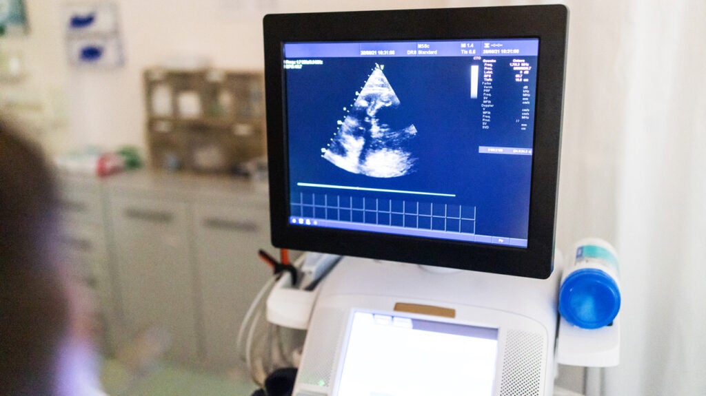 Severe pulmonary hypertension: Definition, symptoms, and more