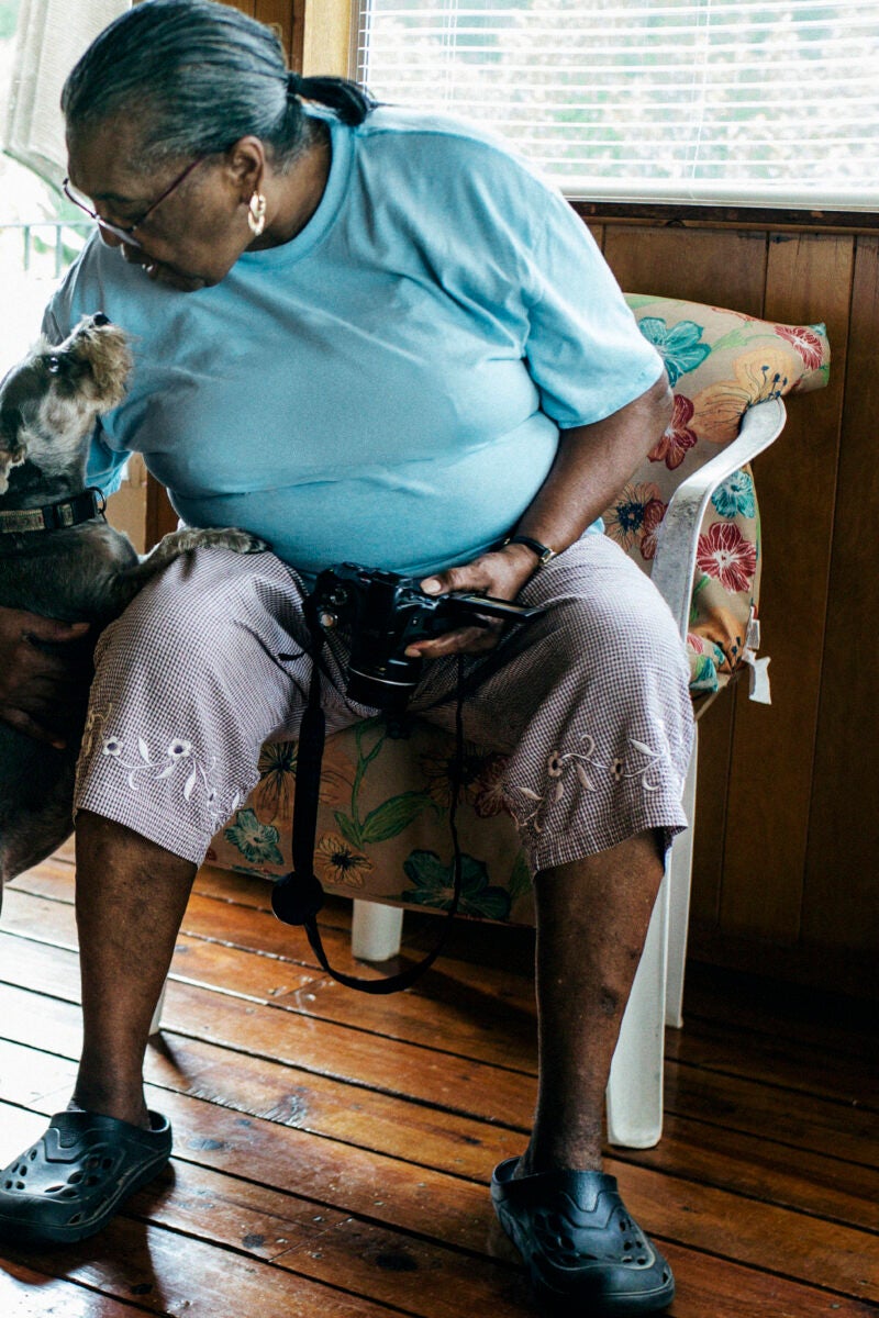 Heart failure and edema: Treatment and life expectancy