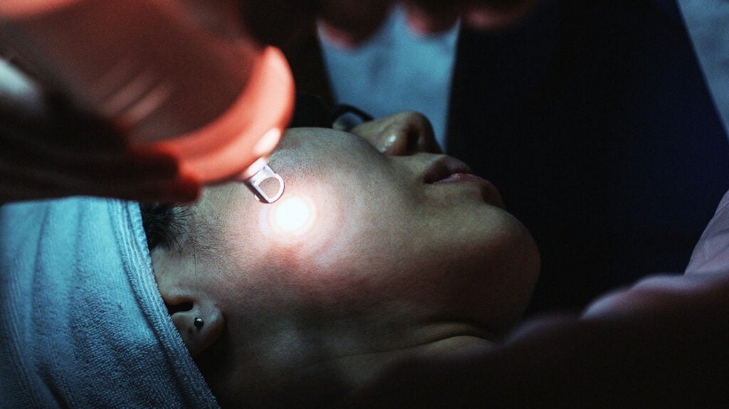 Understanding small cell lung cancer with hyperpigmentation