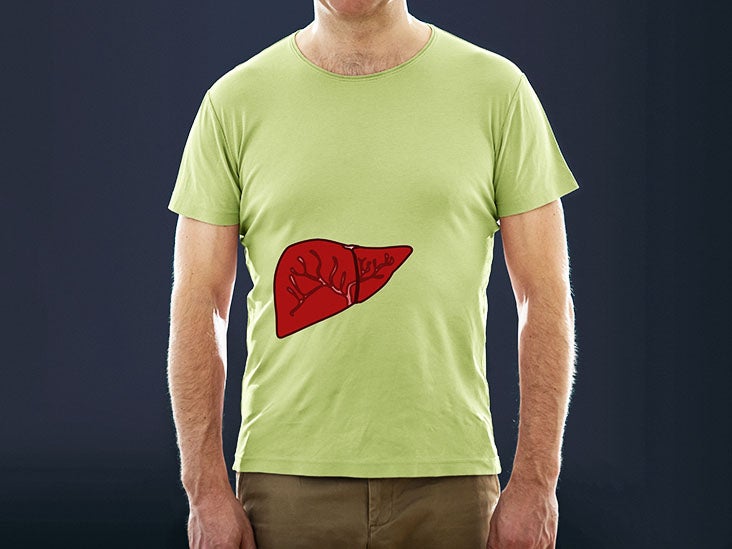 Fatty liver: Genetics and more