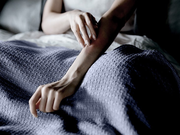 Neurodermatitis: Symptoms, pictures, treatment, and more