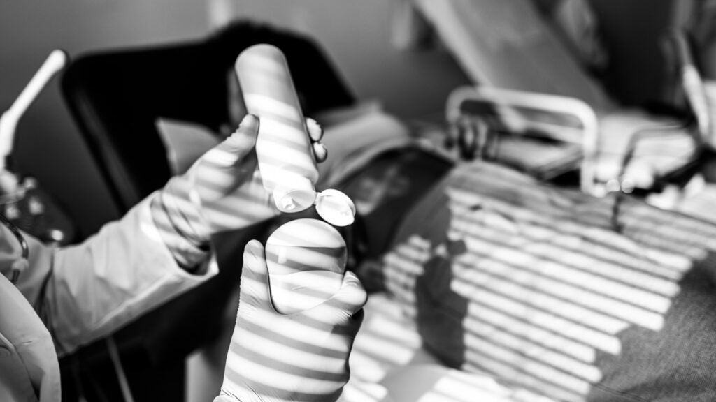 What are the causes of Rett syndrome?