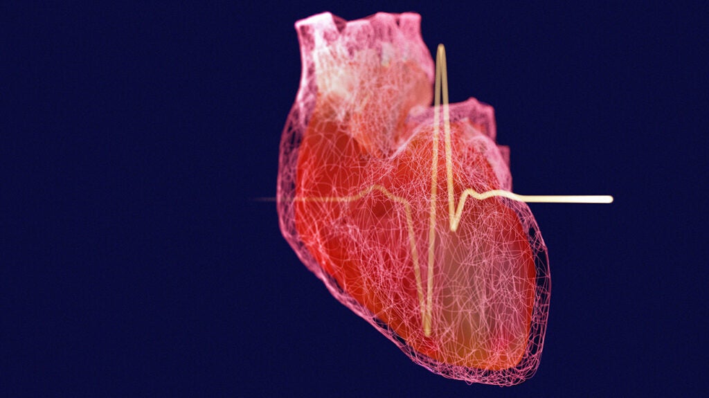 Anxiety and coronary artery spasms: What is the link?