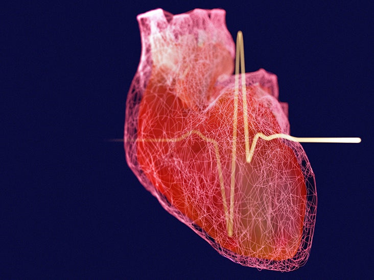 Anxiety and coronary artery spasms: What is the link?