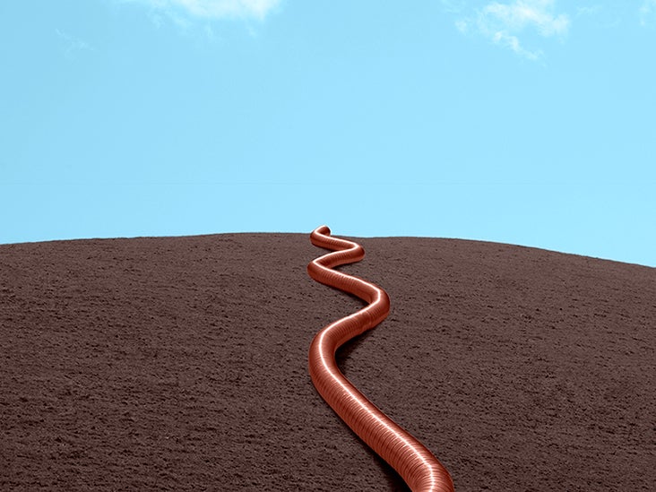 Transesophageal echocardiogram (TEE): What to know about the procedure