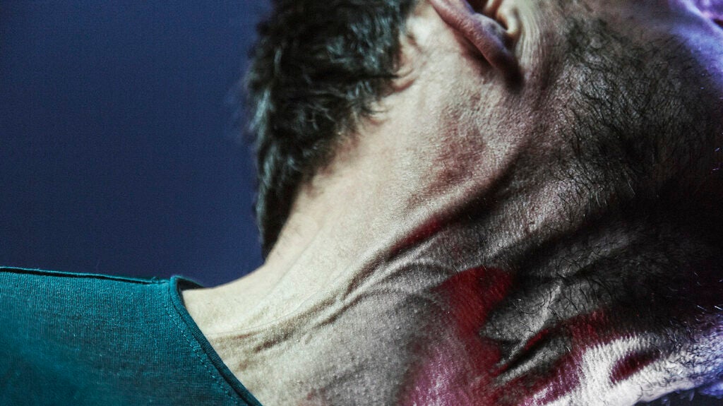 Parathyroid gland removal: An overview