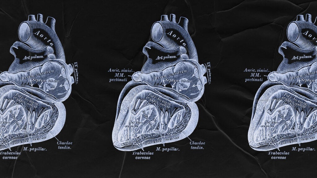 Left sided heart failure: Symptoms, treatment, and outlook