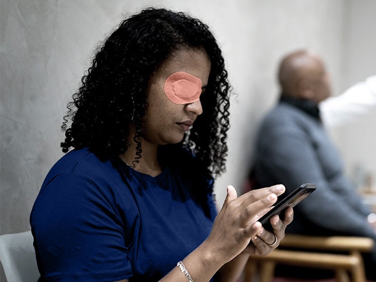 What is scleral buckling?