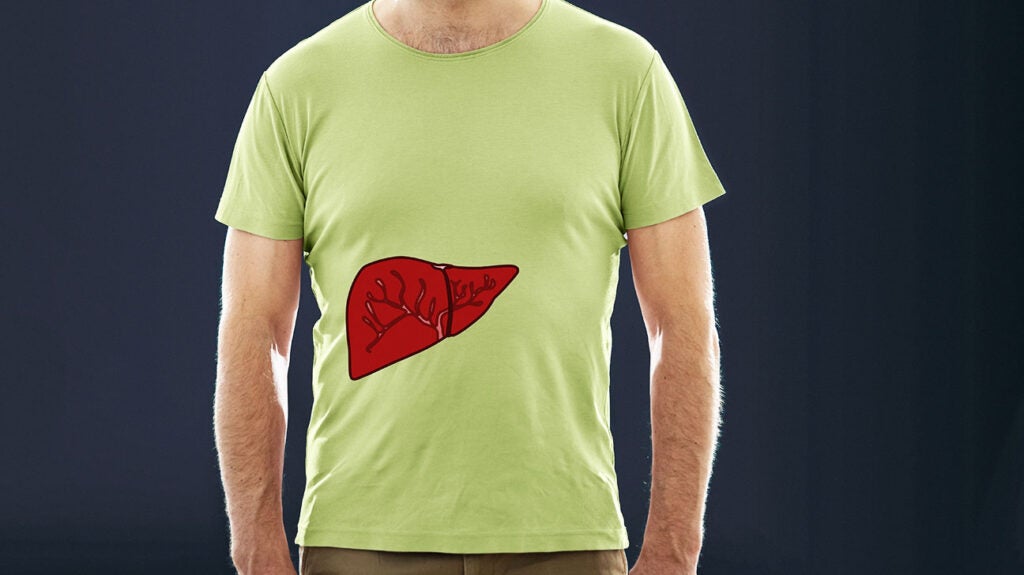 Fatty liver: Genetics and more