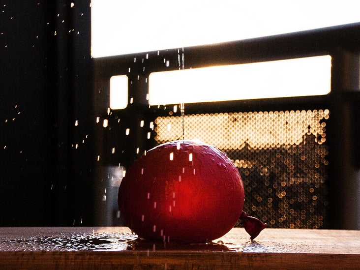 Atonic bladder or underactive bladder: Symptoms and treatment