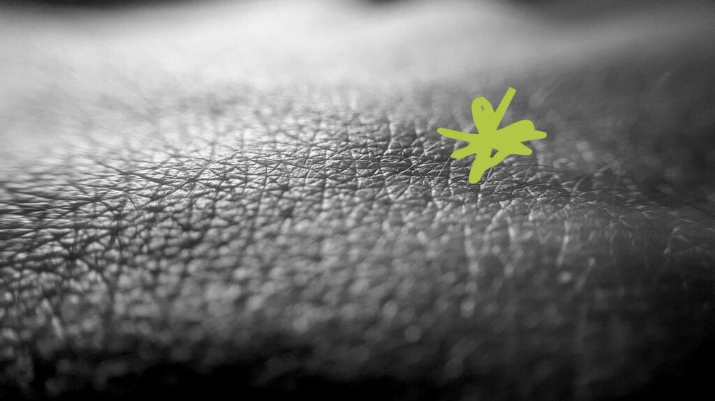 Eczema: How bacteria can accelerate the growth of skin condition