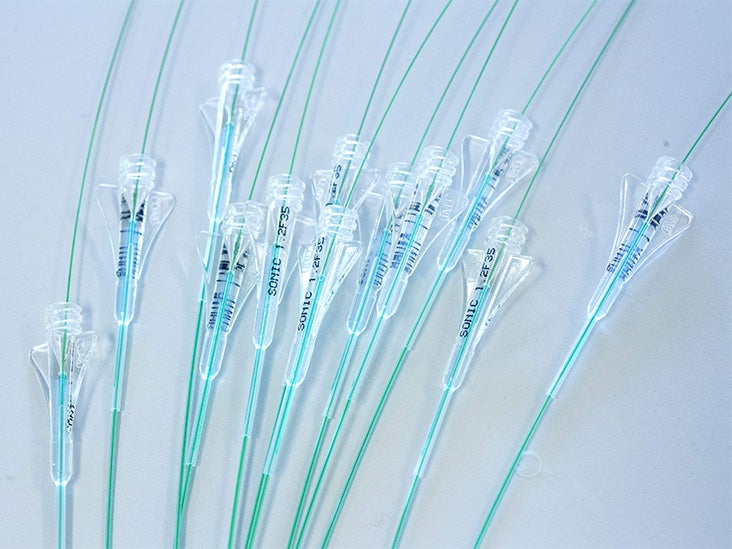 Heart angioplasty and stent placement: Procedure, risks, and recovery