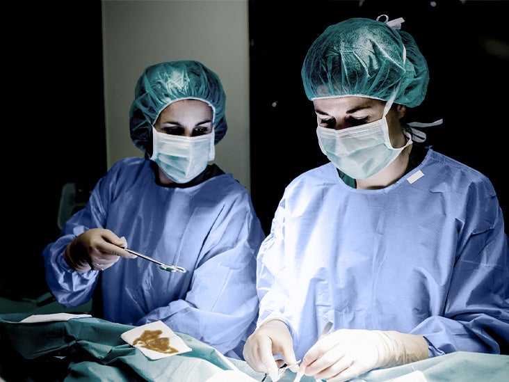 Surgery for GISTs: Procedures and FAQs