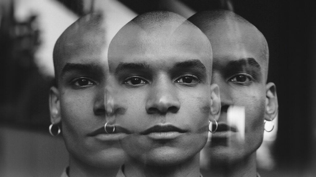 Dissociative fugue: Symptoms, examples, and treatment