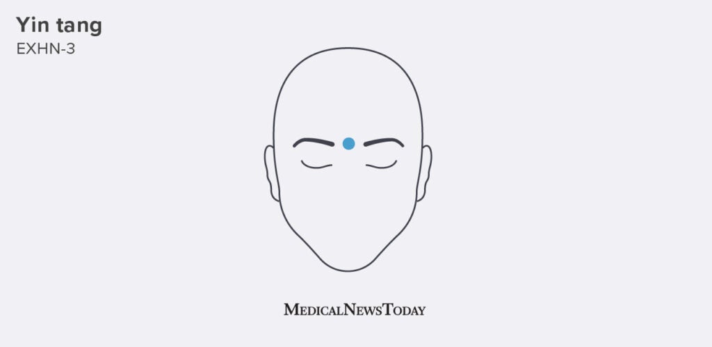 Acupressure: Which points relieve pain?