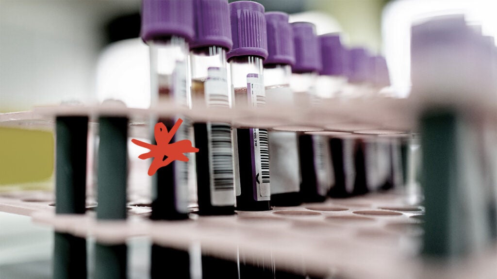 At-home Alzheimer's blood test launches in the US