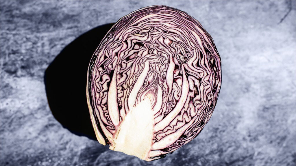 Obesity: How the brain may differ in people who have weight issues