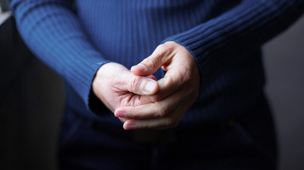 Rheumatoid arthritis nail changes and how to treat them