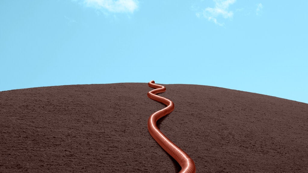 Transesophageal echocardiogram (TEE): What to know about the procedure