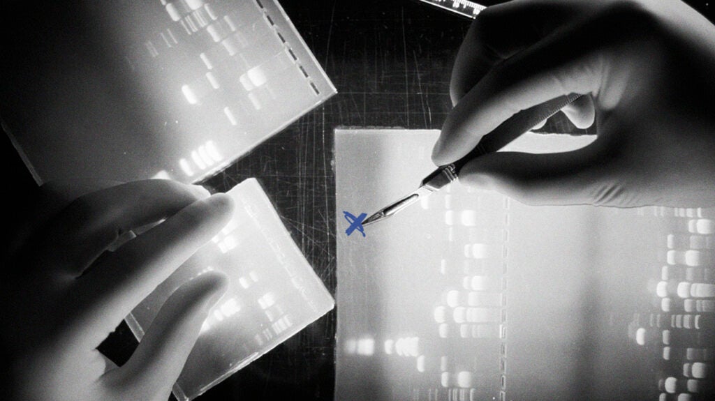 Breast cancer: Scientists identify several new risk genes