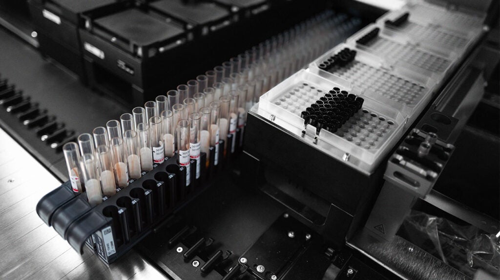 What is a C-Reactive Protein (CRP) Test: Results and more