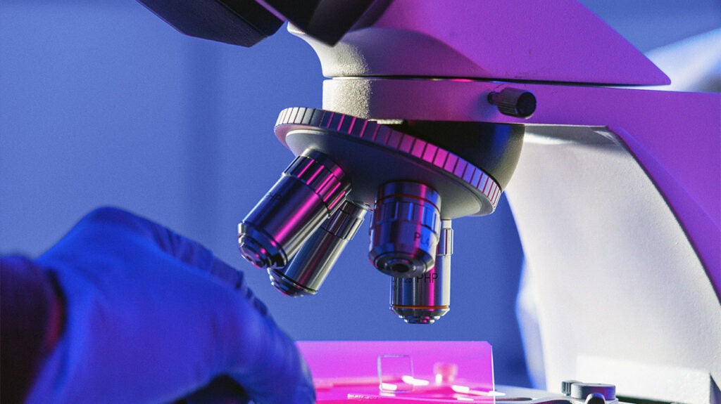 Non-Hodgkin lymphoma types: A guide for clinicians