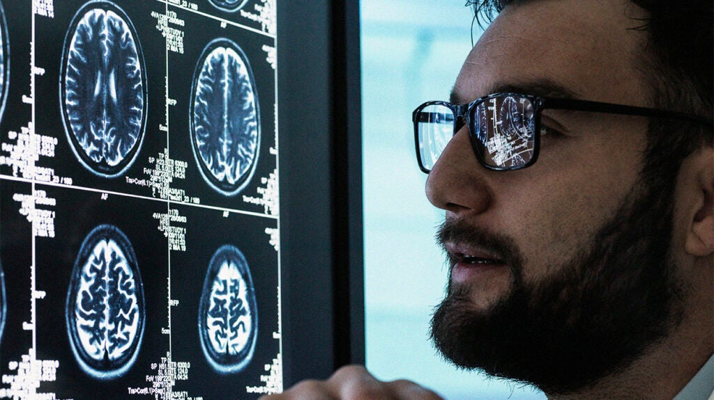 Partial onset seizures: What are some common triggers?