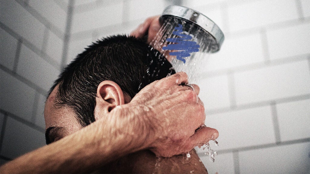 Hidradenitis suppurativa stage 3: Symptoms and more