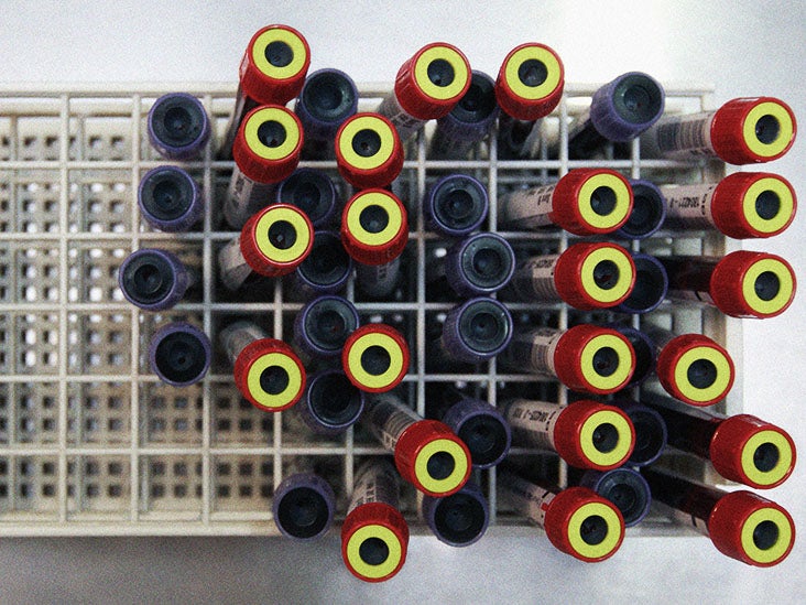 Vitamin B12 level test: Uses, normal ranges, and results