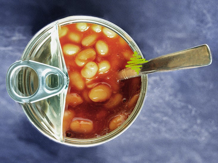 Why am I passing so much gas? Causes and tips for relief