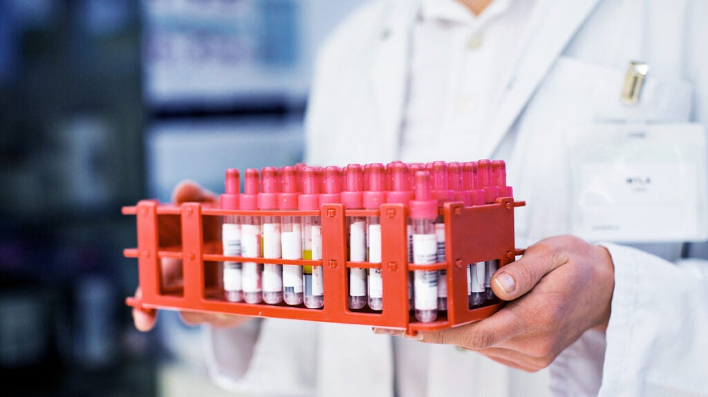 Macrothrombocytopenia: Causes, symptoms, and treatment