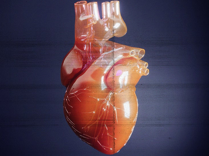 Septal Infarct Causes Symptoms And Diagnosis