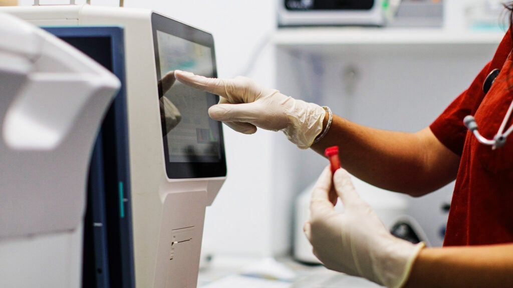 Lung cancer: New blood test may help detect disease earlier